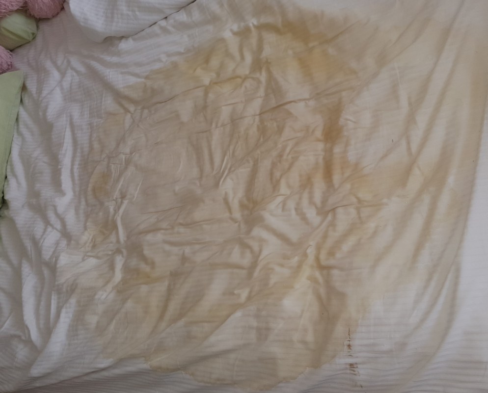 A Seven-day Bedwetting Challenge – AB Discovery