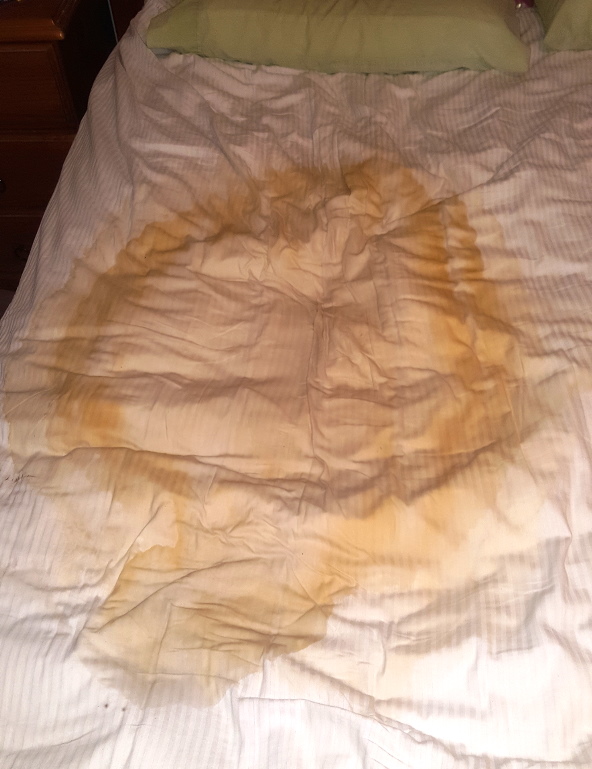 A Seven-day Bedwetting Challenge – AB Discovery